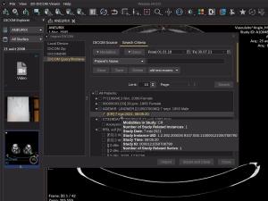 Weasis: Free DICOM viewer :: Weasis Documentation